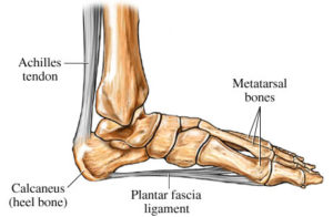 CK Clinic - Plantar Fasciitis blog